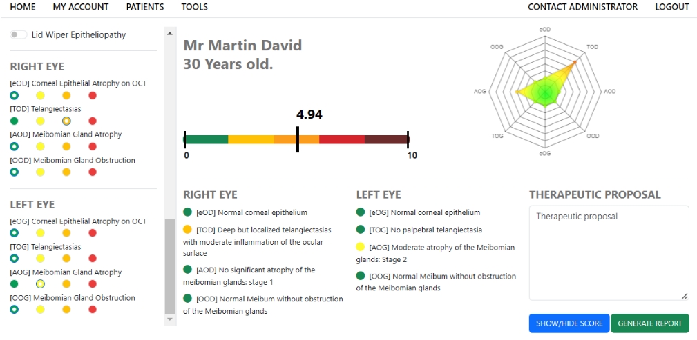 eTAO Dry Eye Score: dedicated to dry eye specialists